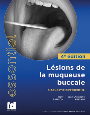 Jacky Samson - Lésions de la muqueuse buccale : diagnostic différentiel
